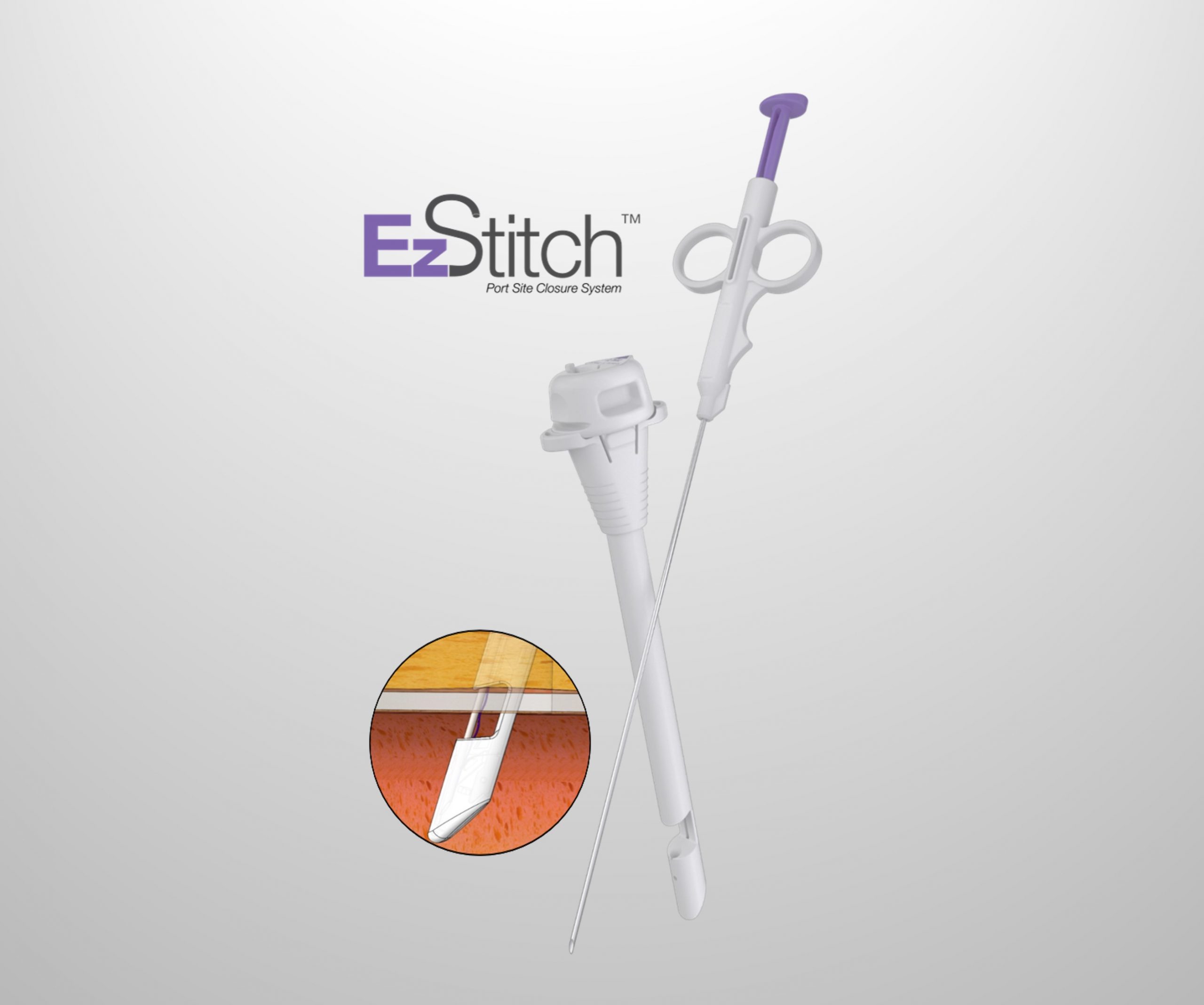 EZ Stitch Closure Device